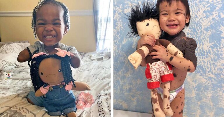 Woman Makes Look-Alike Dolls For Children Born With Physical ...